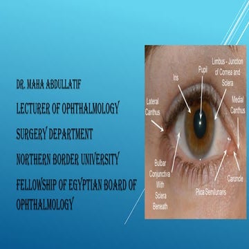 L-2 Eye lid disorder.pdf