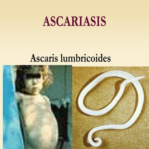 Ascaris Lumbricoides | PPTX