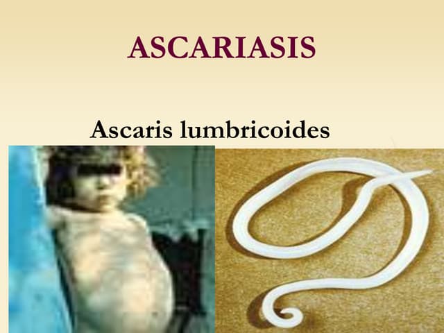Ascariasis | PPTX