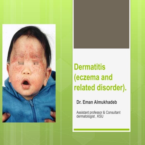 L3-Dermatitis - eczema and related disorder | PPTX