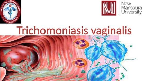 Trichomonas | PPTX