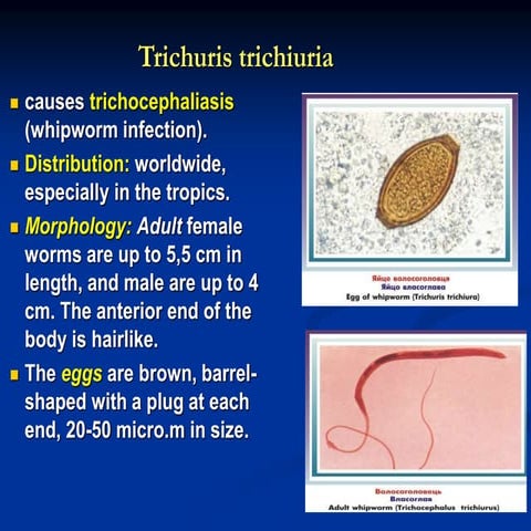 L4 T trichura.pptx