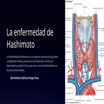La-enfermedad-de-Hashimoto-Hugo Iván Zarmiento Salinas.pptx