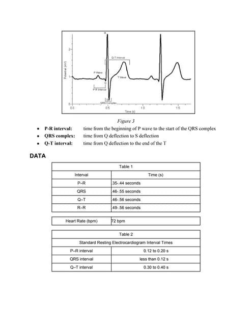 Ekg lab | DOCX
