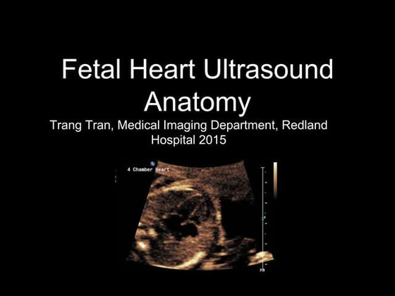 FETAL ECHOCARDIOGRAPHY | PPT