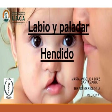 Labio y paladar hendido | PPTX