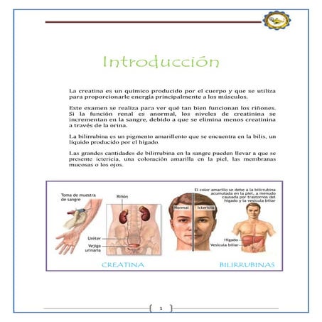 Creatinina (spinreact) | PDF
