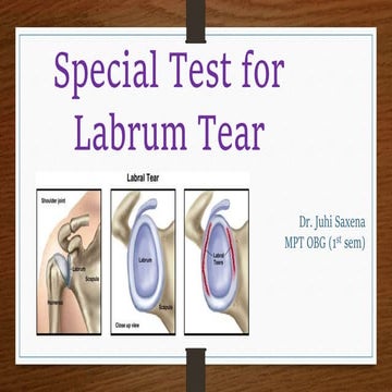 special test for labrum tear .pptx