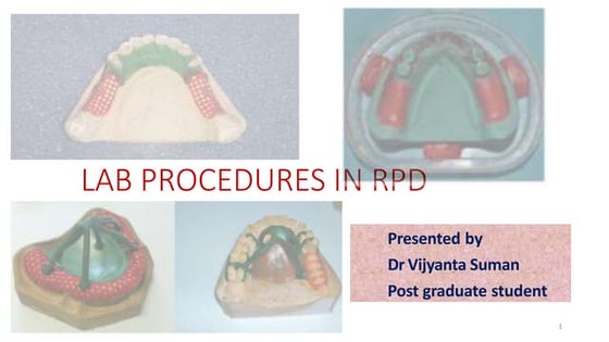 Steps of Fabrication of Removable Partial Denture | PPT