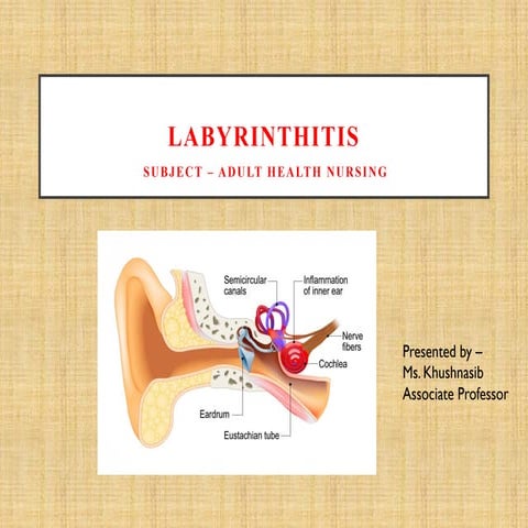 labyrinthitis and nursing management .pptx