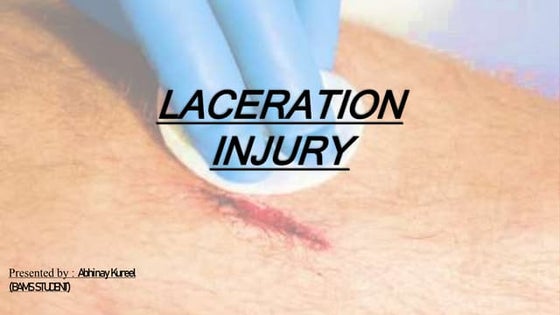 PRESERVATION OF VISCERAS.pptx