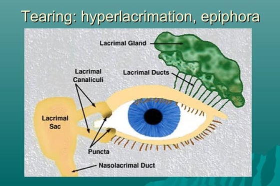 Tests done to assess patency of lacrimal drainage | PPTX | Eye and ...