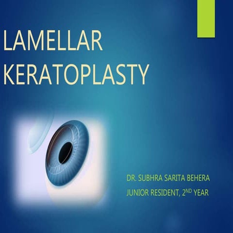 Lamellar keratoplasty | PPTX