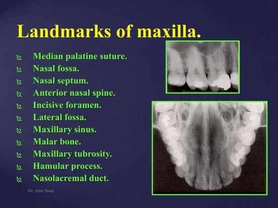 landmarks of face and oral cavity | PPT | Ear, Nose and Throat ...