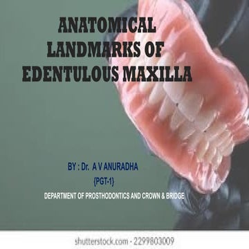 maxillary anatomical landmarks | PPTX