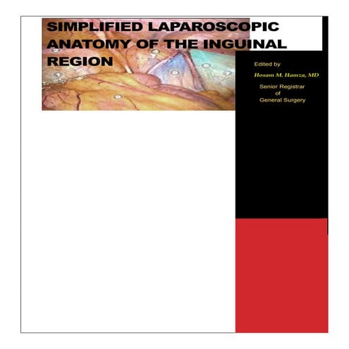 lap anatomy of the inguinal region.pdf