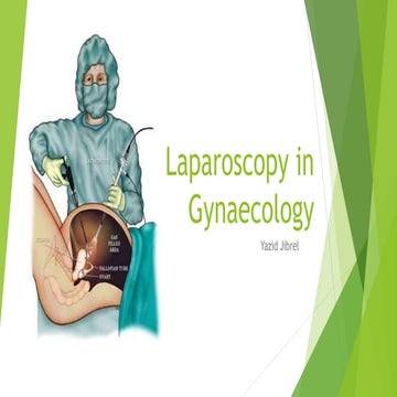 Laparoscopy | PPT
