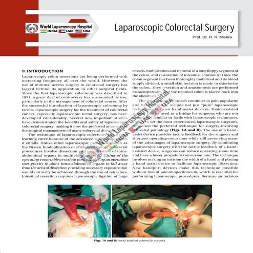 Laparoscopic Colorectal Surgery | PDF