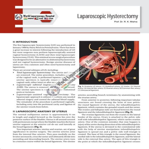 Laparoscopic Hysterectomy | PDF | Pregnancy | Reproductive Health