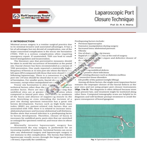 Laparoscopic Port Closure Technique Pdf