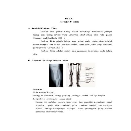 Laporan pendahuluan tibia | DOCX