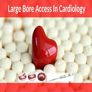 Large bore access in cardiology very imp | PPTX