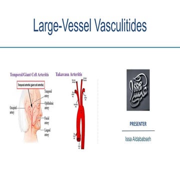 Large Vessel Vasculitides - Issa Aldababseh.pptx | Heart and ...