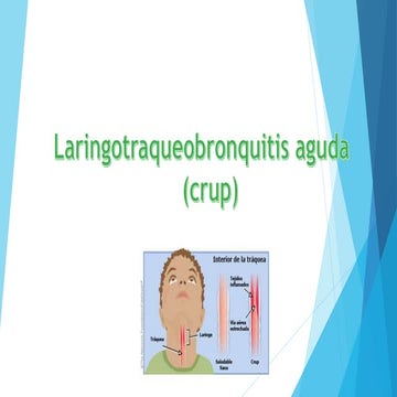 Laringotraqueobronquitis aguda (crup) , bronquitis, bronquiolitis | PPTX