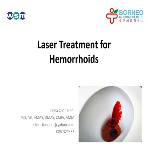 Laser Treatment for Hemorrhoids | PPTX