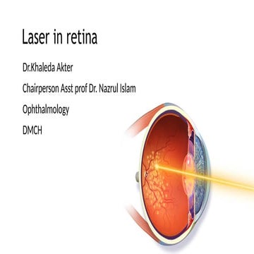 BASICS OF PAN RETINAL, SECTOR AND FOCAL RETINAL LASER PHOTOCOAGULATION.pptx