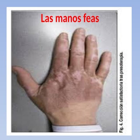 Las manos feas de mamá Taller para estudiantes.pptx