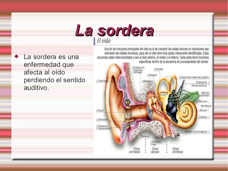 La sordera