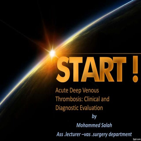 Homan’s Sign for DVT.pptx