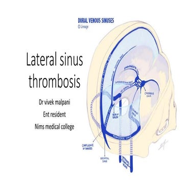 lateral venous sinus.pptx