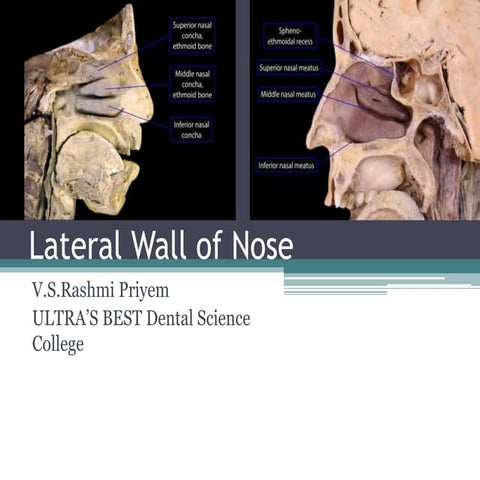 Lateral Wall of Nose | PPTX
