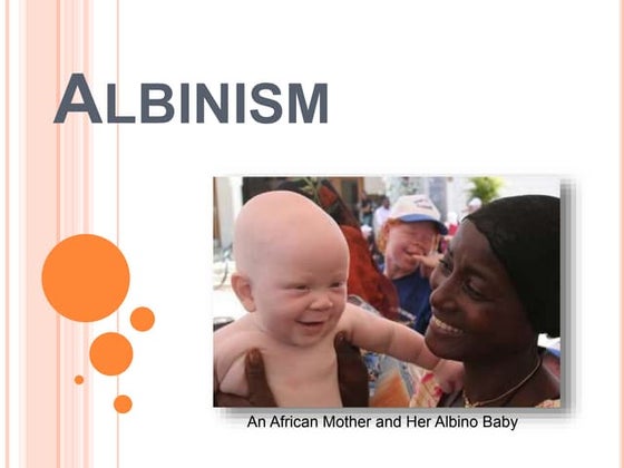 Albinism | PDF | Eye and Vision Conditions | Diseases and Conditions