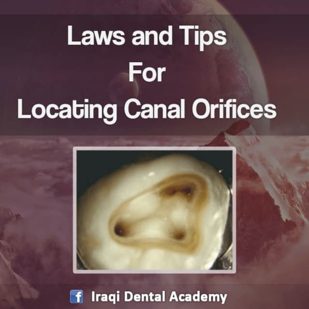 Laws and Tips for Locating Canal Orifices | PDF