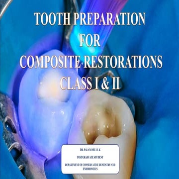 Class I , II Composites Cavity preparations | PPTX