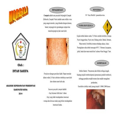 Leaflet morbili akper pemda muna | PPT