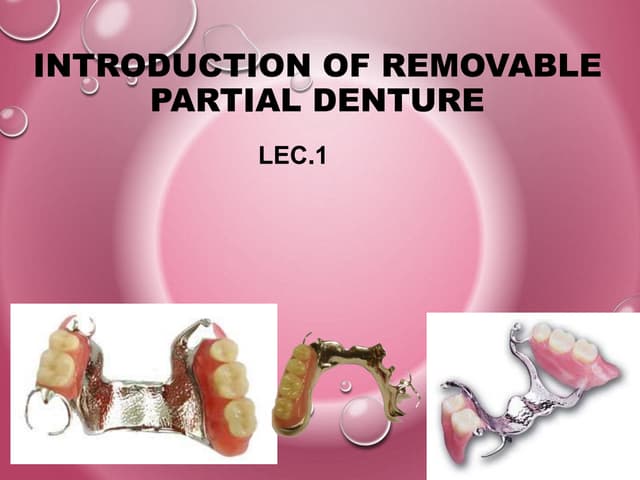 Removable Partial Denture 1. Introduction | PDF