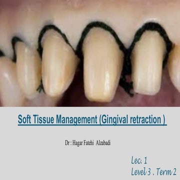 Retraction cords | PPTX