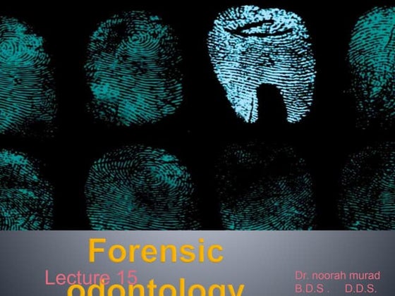 Bite Marks (FORENSIC DENTISTRY) | PPTX