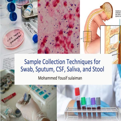 Sample Collection Techniques for Swab, Sputum, CSF, Saliva, and Stool | PDF