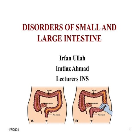 Lec # 5 Disorders of small & large Intestine.ppt
