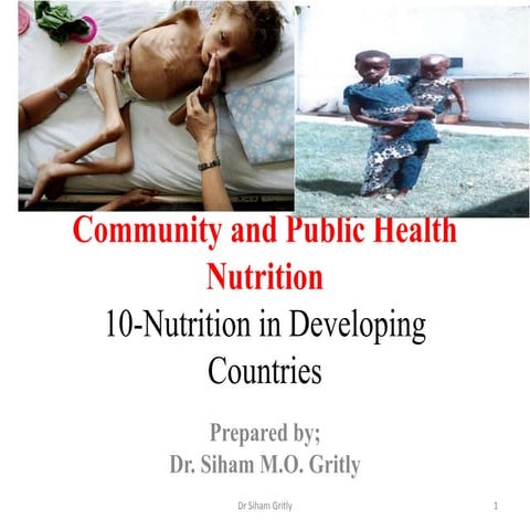 Lec 9 nutrition in developing countries | PPTX
