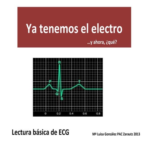 Lectura de ECG | PPT