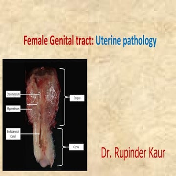 Lecture 2 Pathology: Uterus pdf | PPT