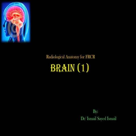 CT and MRI anatomy of brain | PDF