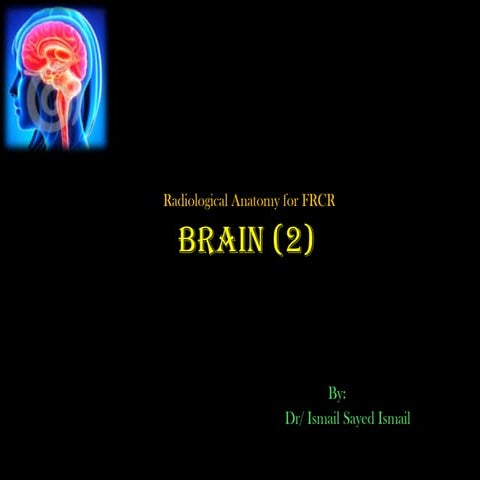 Radiological anatomy of the brain2.pptx