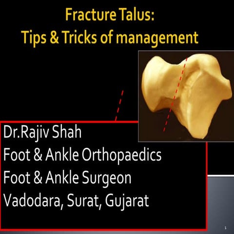 Lecture 14 shah fracture talus | PPTX
